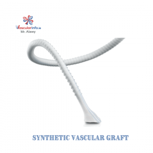 Femoral Popliteal Bypass - Vascular Info